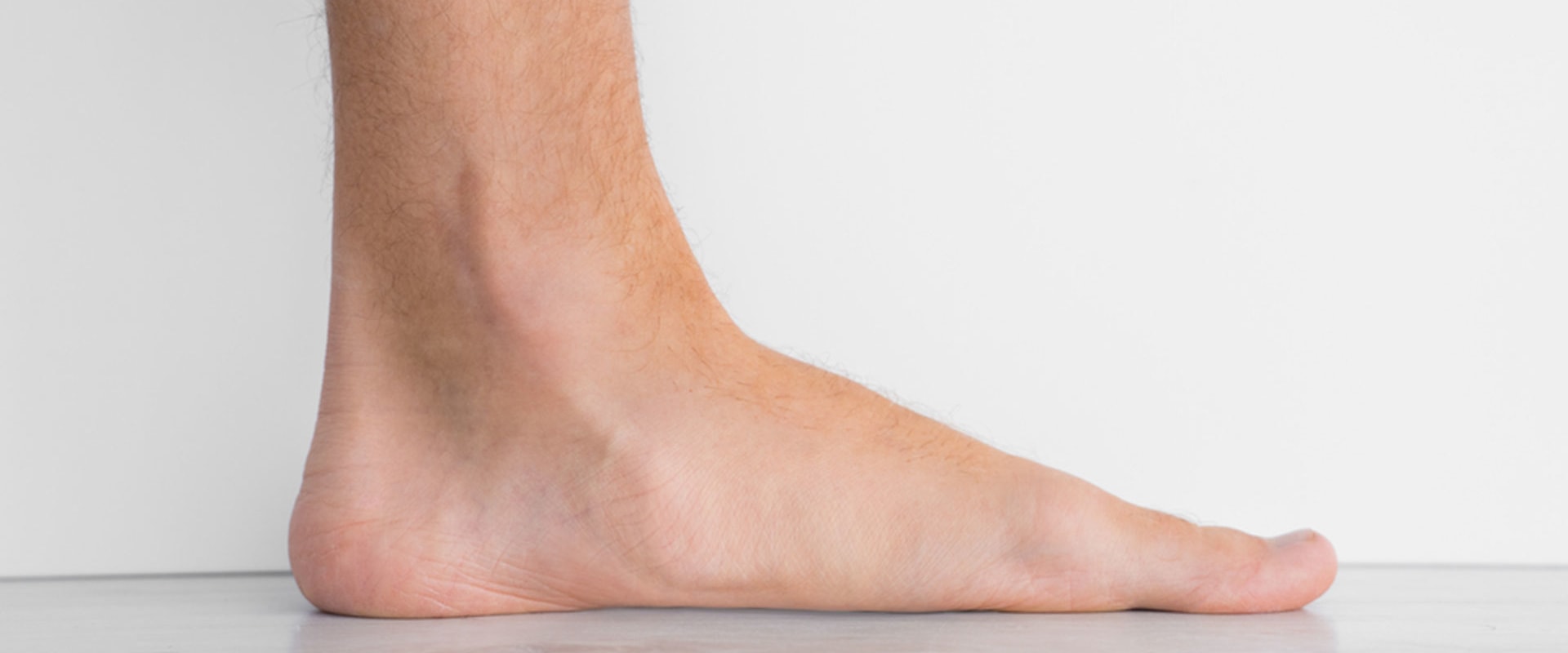Understanding Flat Feet as a Military Disability