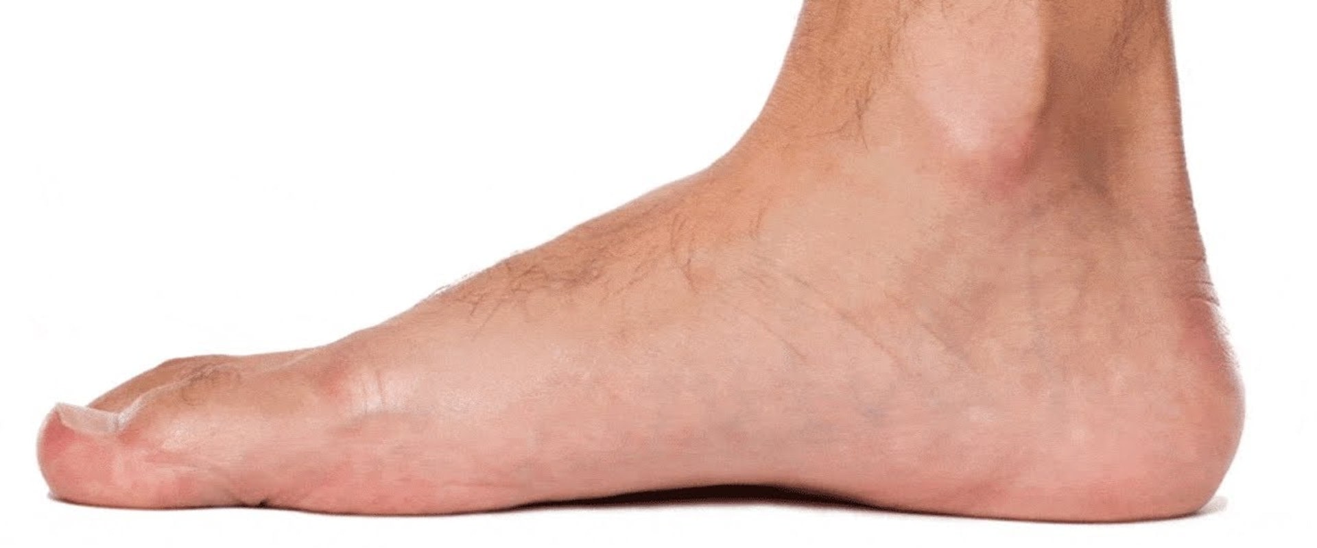 Debunking Myths and Understanding Disability Benefits for Flat Feet