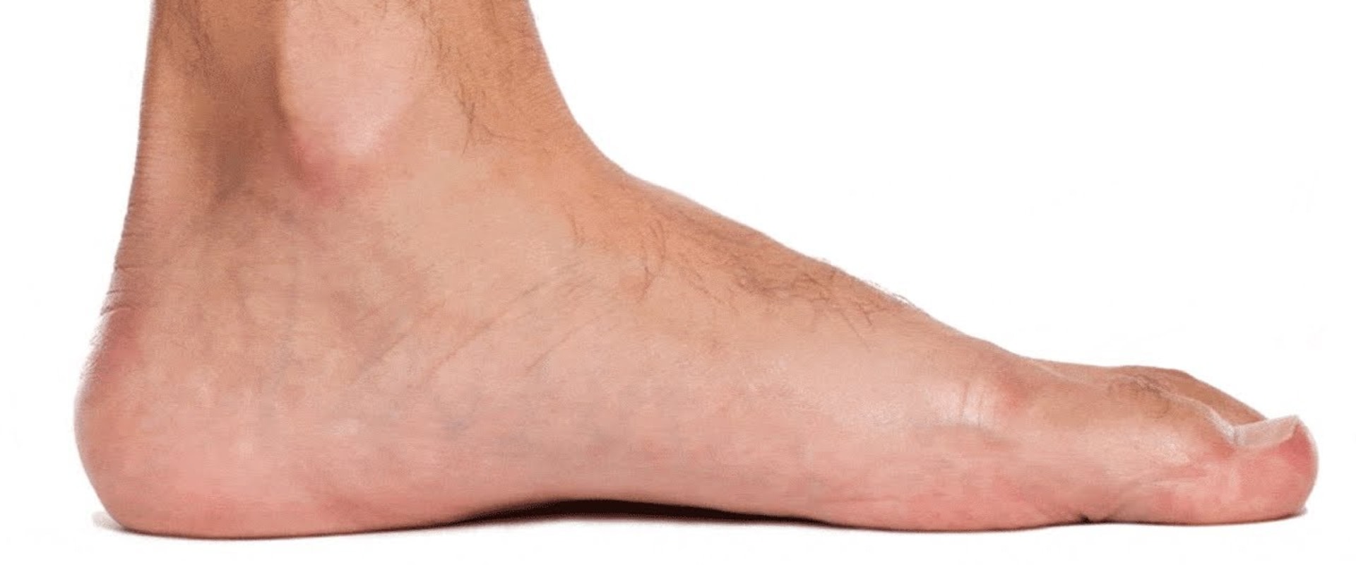 The Truth About Flat Feet: Dispelling Myths and Understanding the Risks