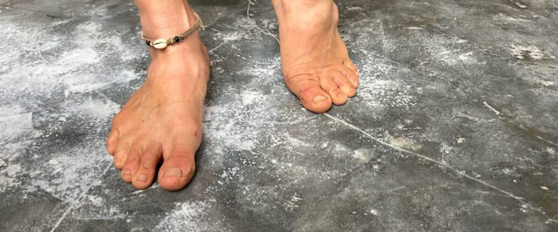 The Truth About Flat Feet: Debunking Myths and Providing Solutions